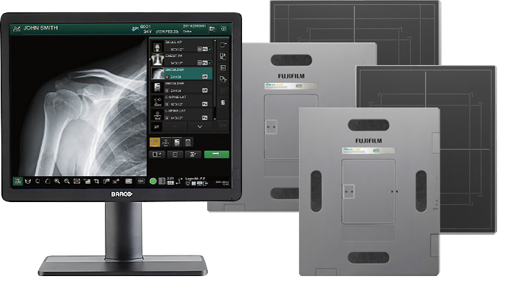 FujiFilm FDR ES | Direct Radiology X-Ray Design, Set-Up, Sourcing