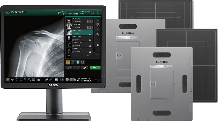 FujiFilm FDR ES | Direct Radiology X-Ray Design, Set-Up, Sourcing