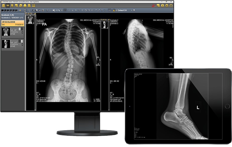 EvoView PACS | X-Ray Design, Set-Up, Sourcing