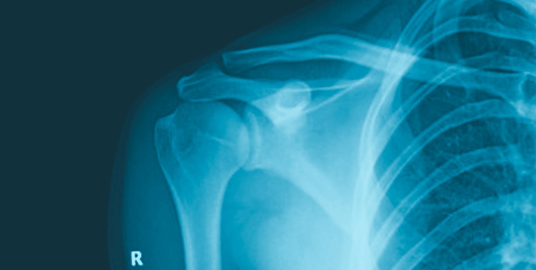 Fujifilm FDX Console | Computed Radiology X-Ray Design, Set-Up, Sourcing