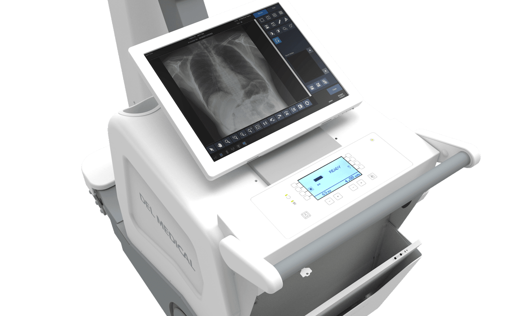 Del Medical MDR | Direct Radiology X-Ray Design, Set-Up, Sourcing